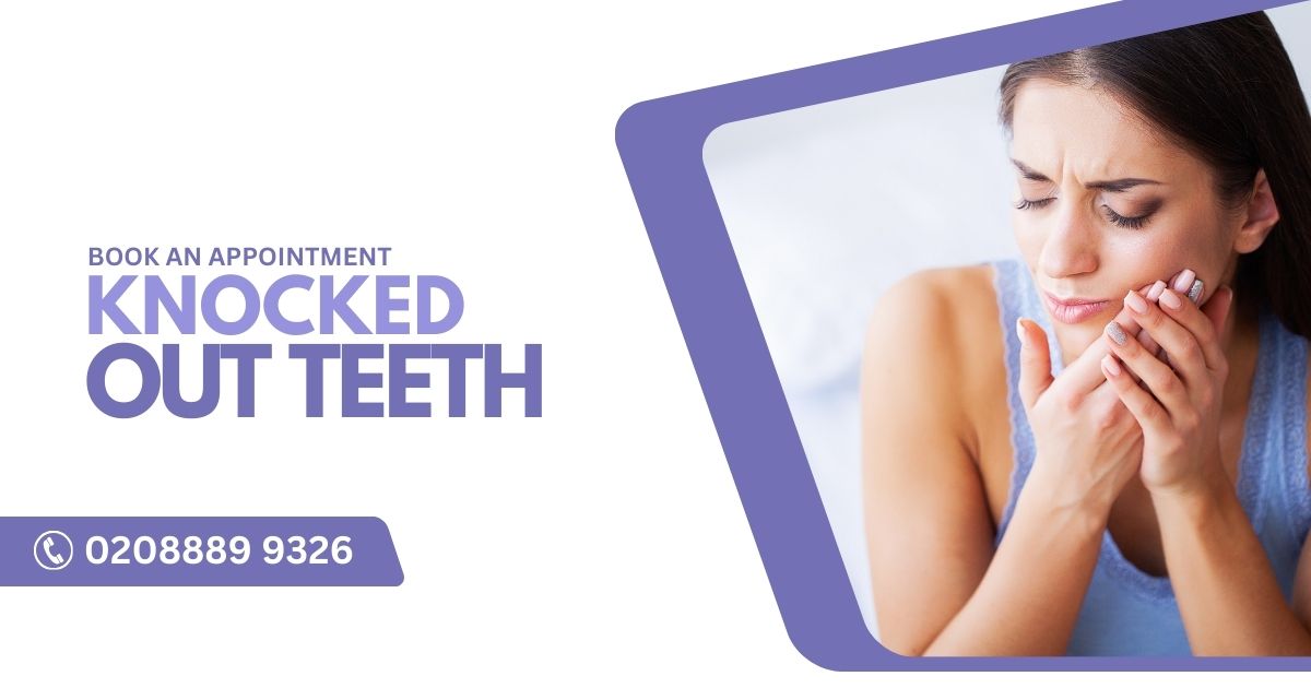 Front Knocked Out Tooth Treatment – Wimbledon Dentist