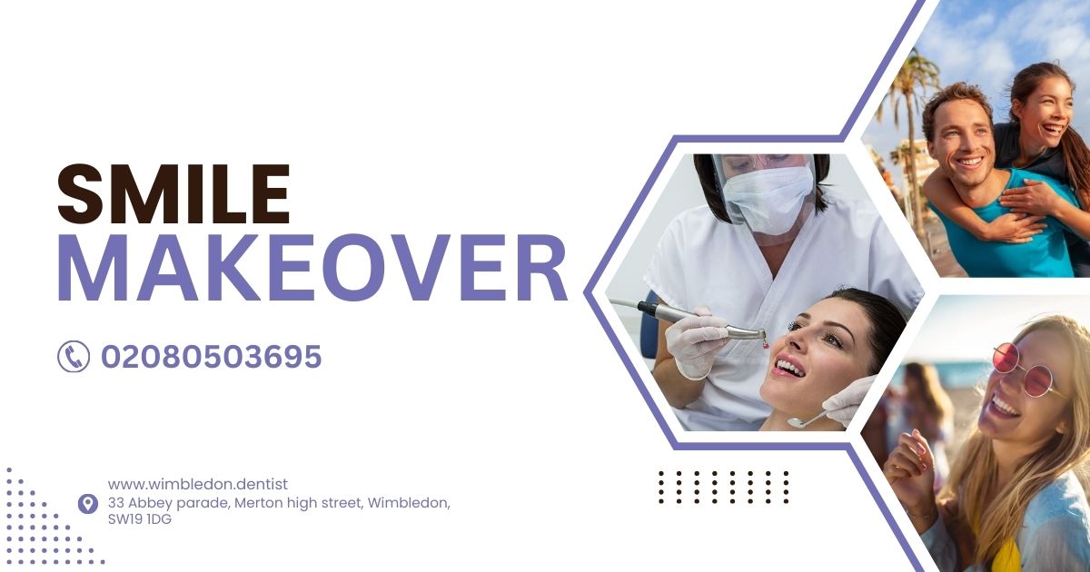 Smile Makeover London – Smile Makeover Dentist Near Me
